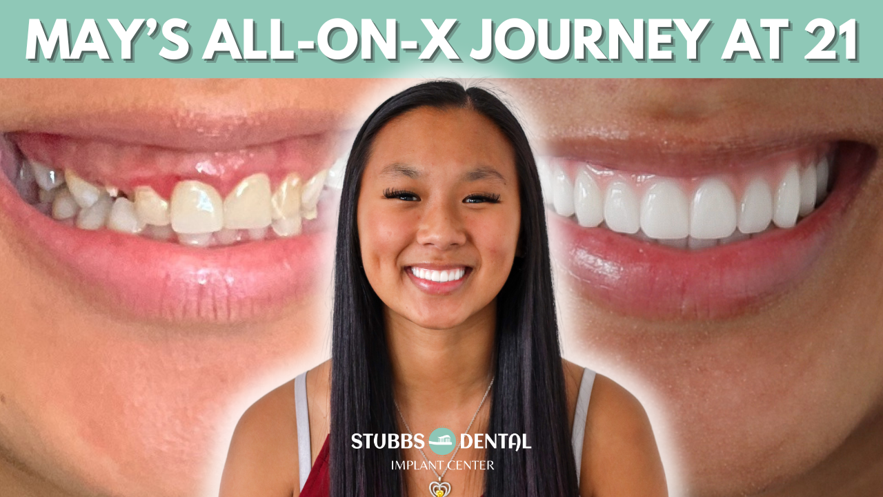 A Life-Changing Smile Makeover at 21: May’s Journey of Dental Implants